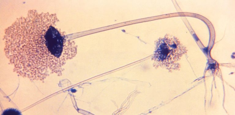 Mucormicosis u “hongo negro”: ¿qué es y por qué afecta a los pacientes ...