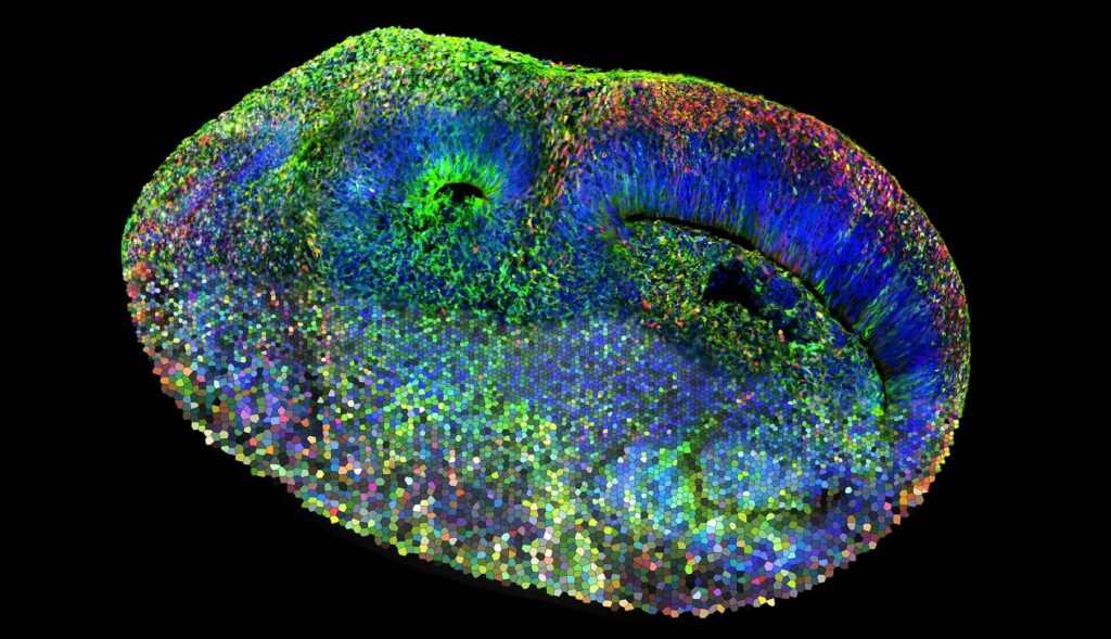 Organoides cerebrales para desvelar los enigmas genéticos del autismo ...